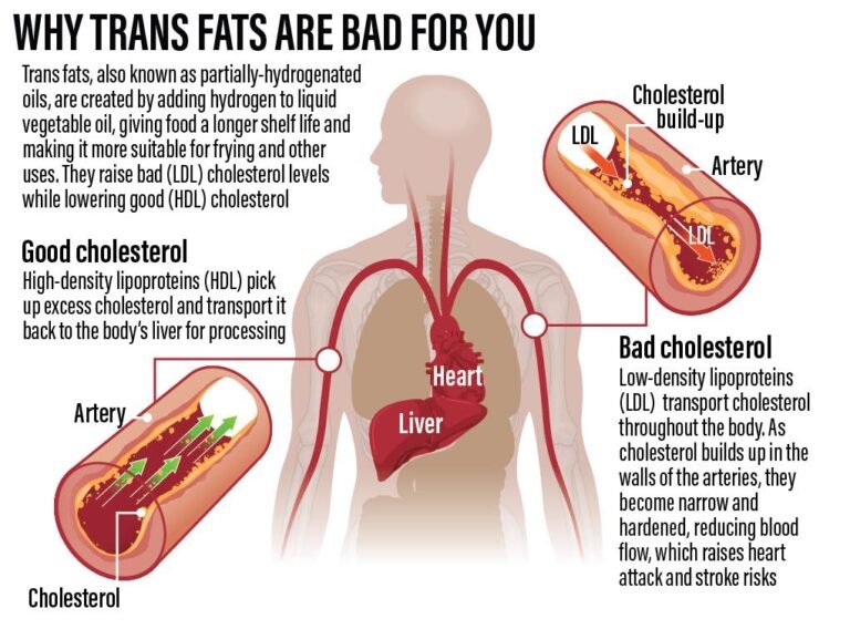 A Step forward for Eliminating Industrially Produced Trans Fats - HRDO